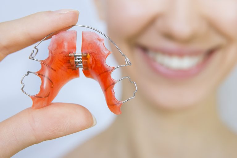 Functional Appliances Mansfield | Orthodontist Nottinghamshire
